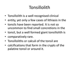 Tonsilloliths