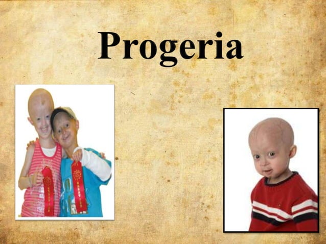 Aging disoder and orthopedics disorders | PPT