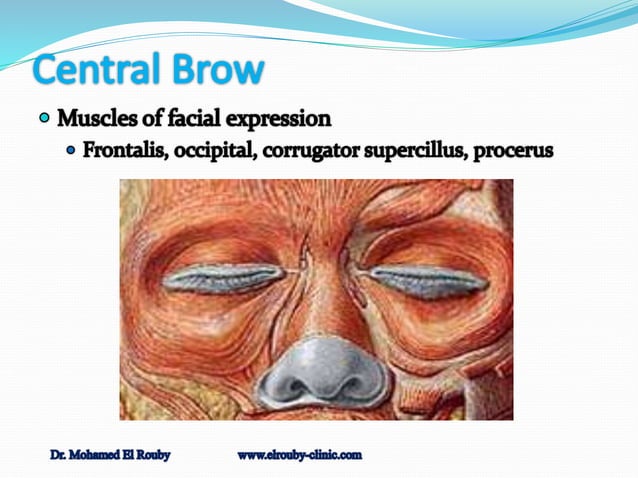 Aging upper face | PPT