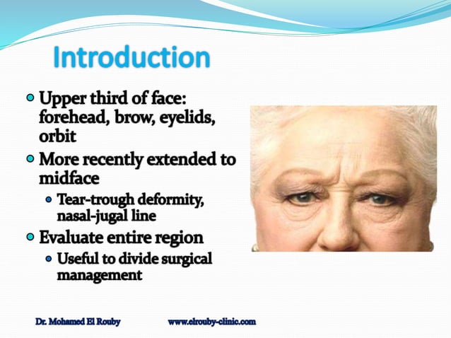 Aging upper face | PPT