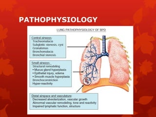 A glance at BPD | PPTX | Lung and Respiratory Health | Diseases and ...