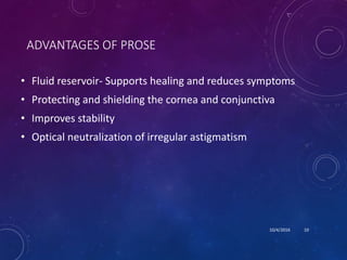 A glimpse through scleral contact lenses (PROSE) | PPT