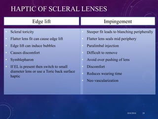 A glimpse through scleral contact lenses (PROSE) | PPT
