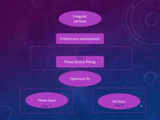 A glimpse through scleral contact lenses (PROSE) | PPT