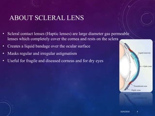 A glimpse through scleral contact lenses (PROSE) | PPT