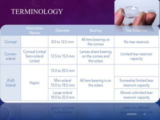 A glimpse through scleral contact lenses (PROSE) | PPT