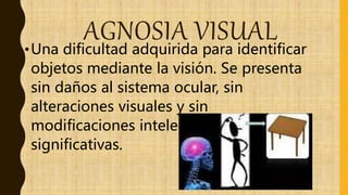 Agnosia.pptx