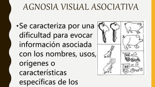 Agnosia.pptx
