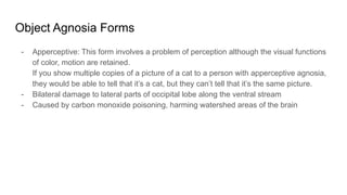 Agnosia.pdf.............................. | PPT