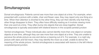 Agnosia.pdf.............................. | PPT