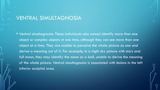 Agnosia is a rare disorder whereby pattt | PPTX
