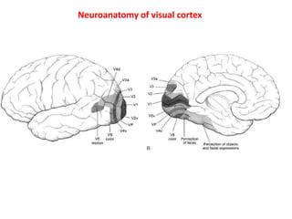 Visual Agnosia Brain