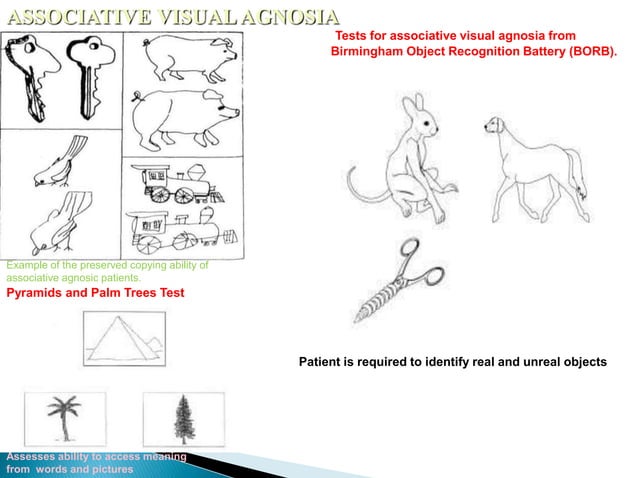 AGNOSIA | PPTX | Eye and Vision Conditions | Diseases and Conditions