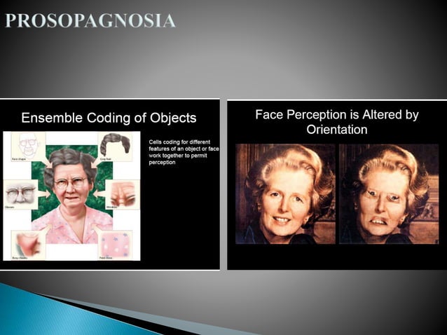 AGNOSIA | PPTX | Eye and Vision Conditions | Diseases and Conditions