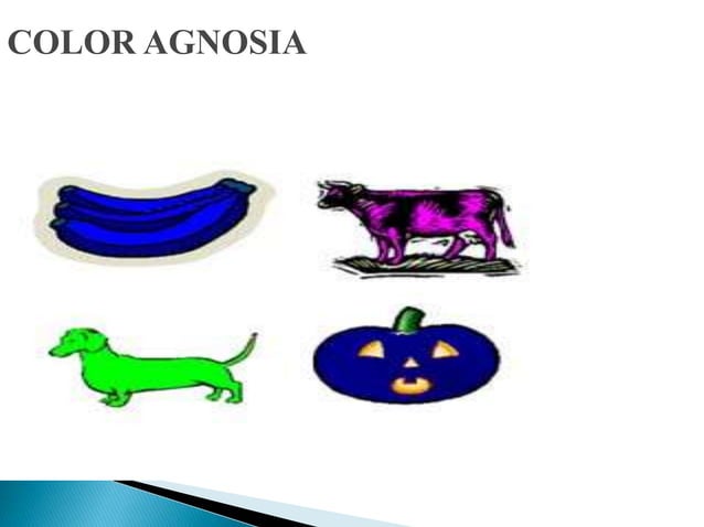 AGNOSIA | PPTX | Eye and Vision Conditions | Diseases and Conditions