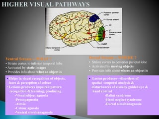 Visual Agnosia Brain