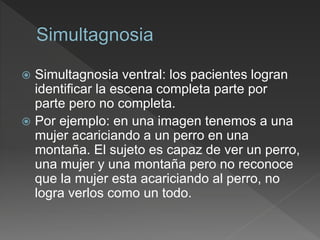 Agnosias neuropsicologia Psicofisiologia | PPTX