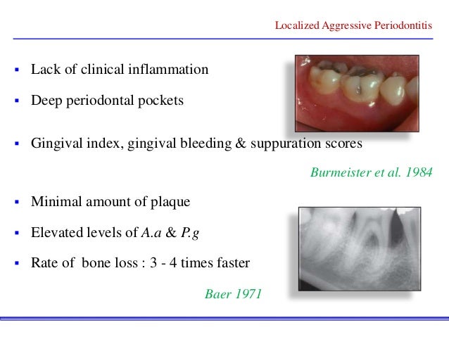Aggressive periodontitis