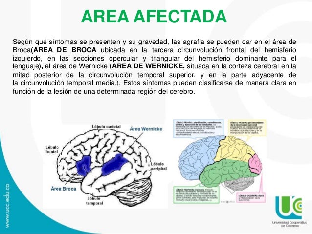 Agrafia 1
