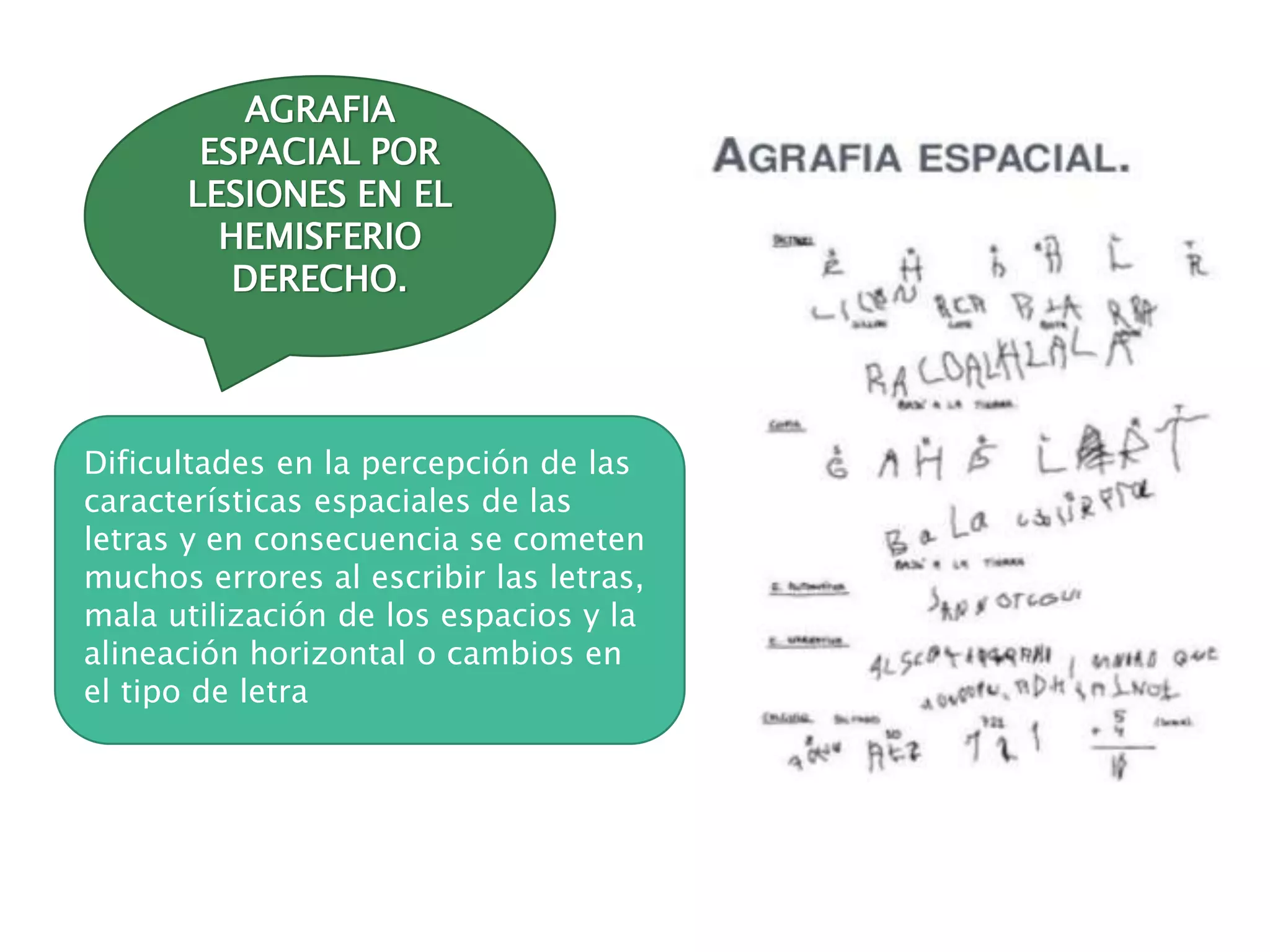 Agrafias diapositivas | PPT