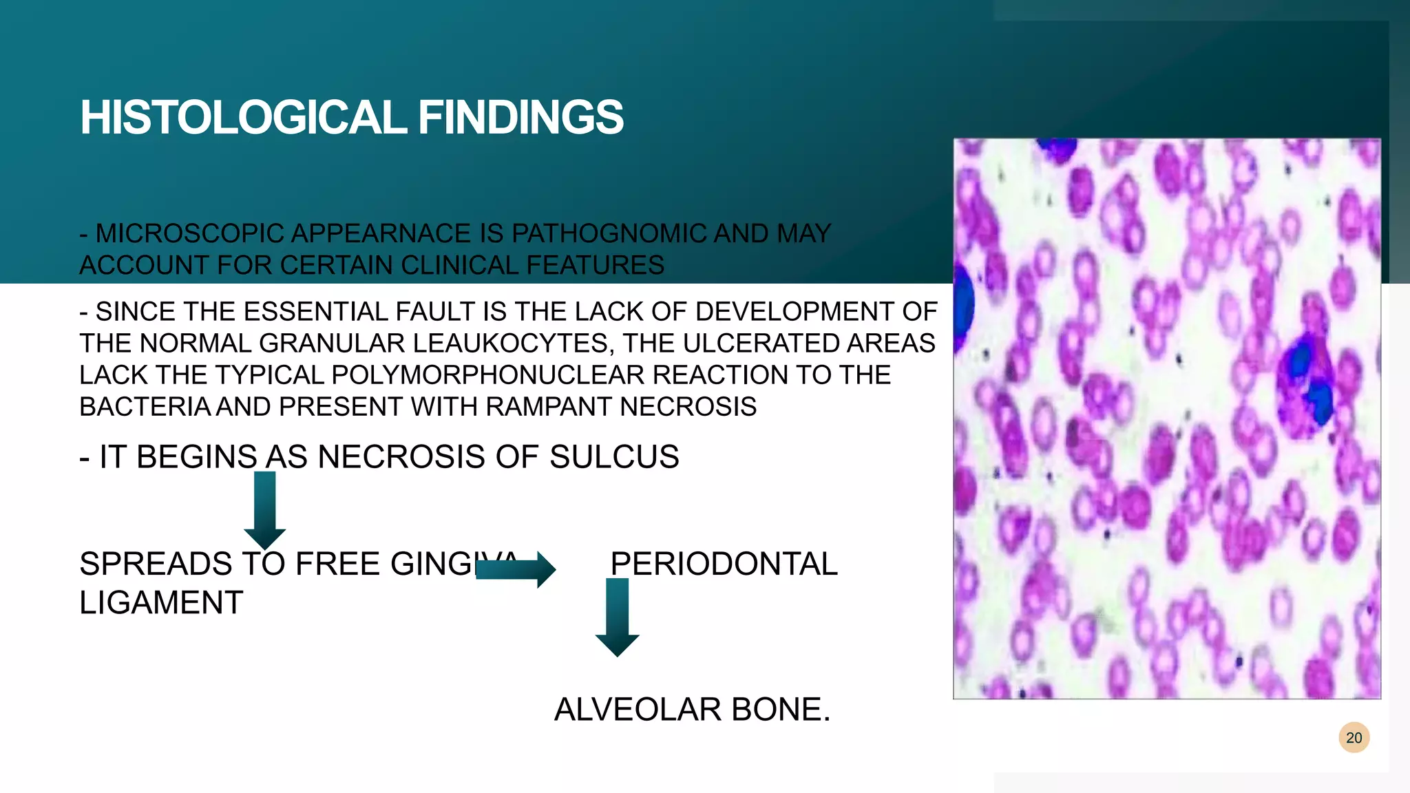 Agranulocytosis oral pathology | PPTX