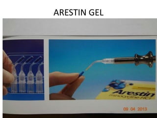 agressive periodontitis.pptx