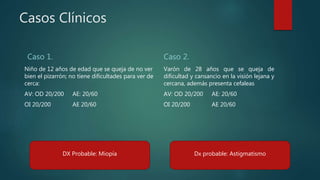 Agudeza visual | PPTX