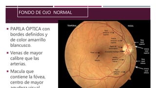 Agudeza visual | PPTX
