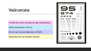 agudeza visual.pptx