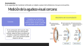 agudeza visual.pptx
