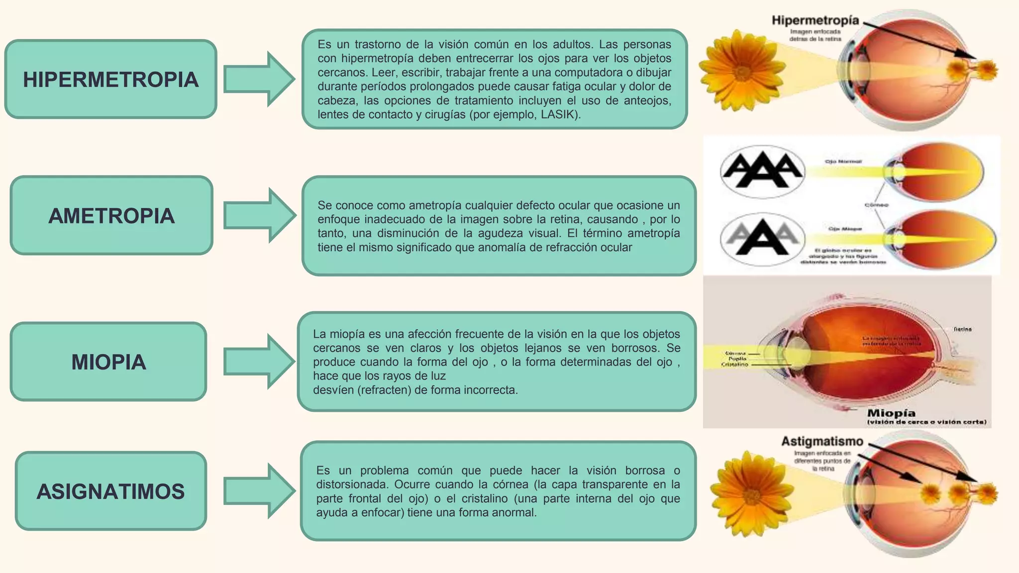 agudeza visual.pptx