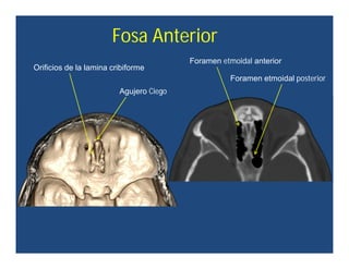 Agujeros de la base del cráneo.pdf