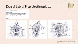 female anterior urethroplasty techniques | PPTX