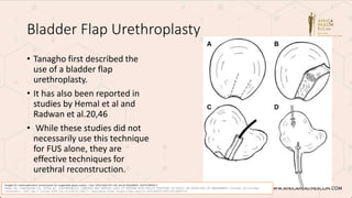 female anterior urethroplasty techniques | PPTX