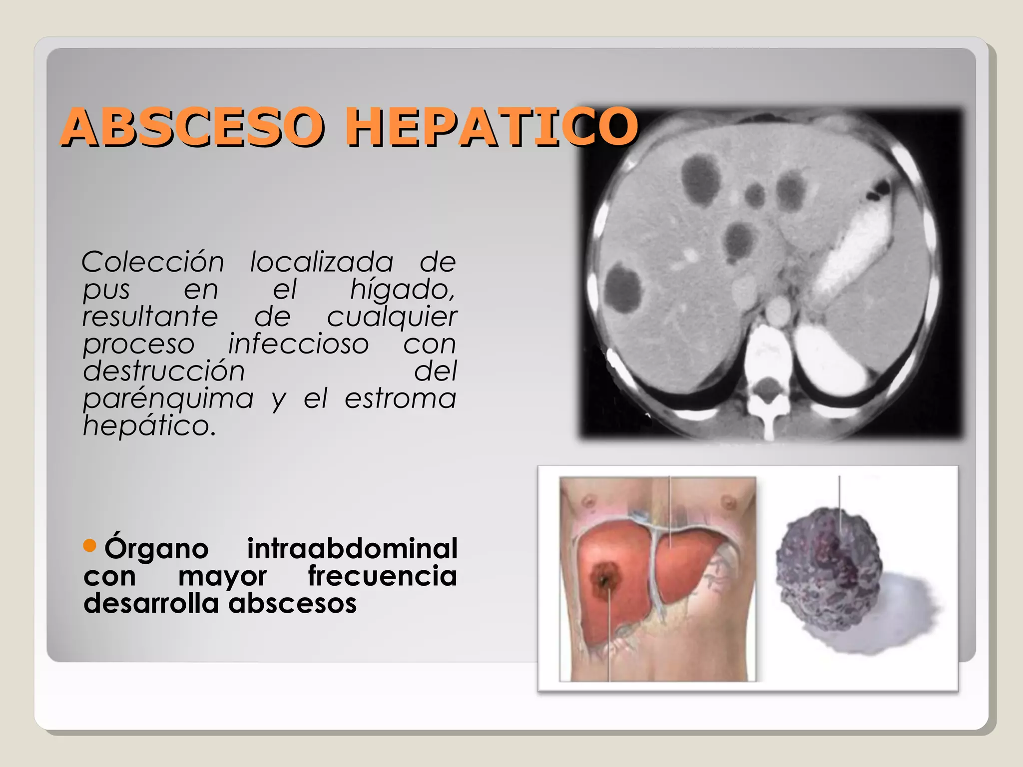 Absceso Hepático Amebiano | PPT