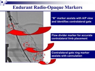 Aha endurant veith 2010 | PPT