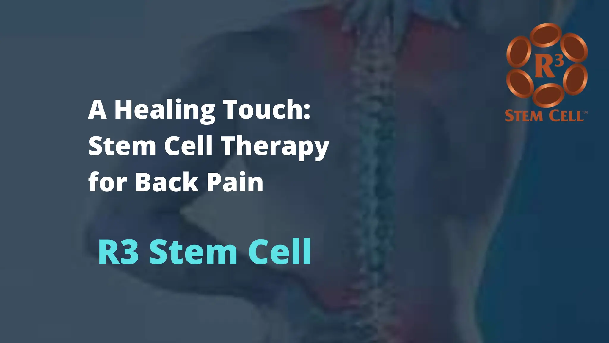 A Healing Touch: Stem Cell Therapy for Back Pain | R3 Stem Cell | PPT