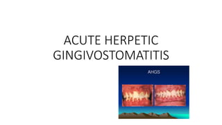 Ahgs | PPTX