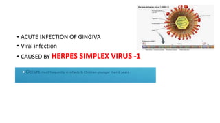Ahgs | PPTX
