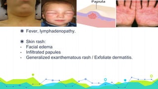 drug reaction with eosinophilia and systemic symptom | PPTX