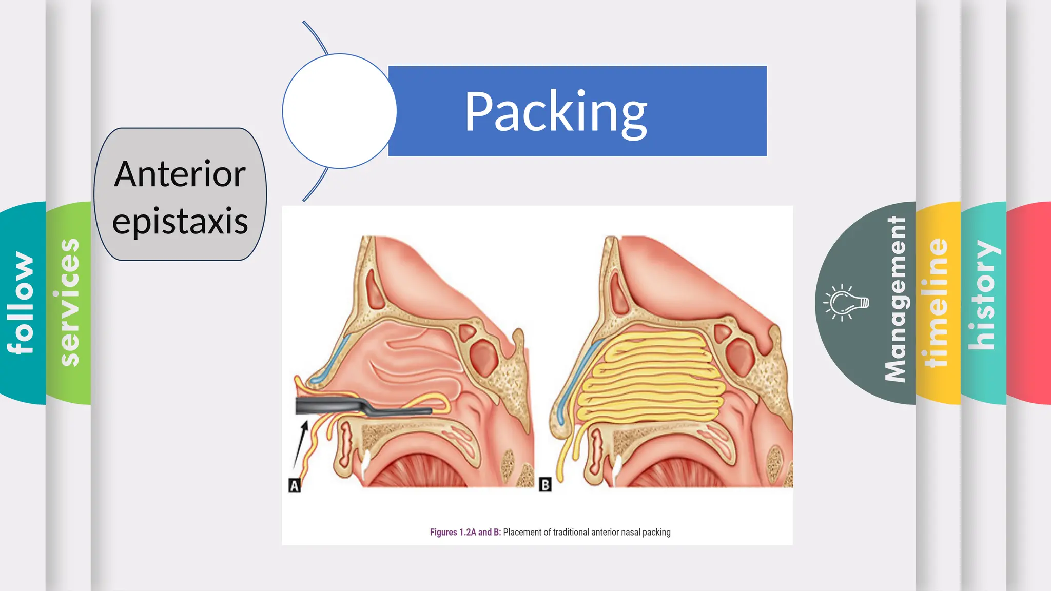 Epistaxis clinical guidelines AlAdan Hospital .pptx