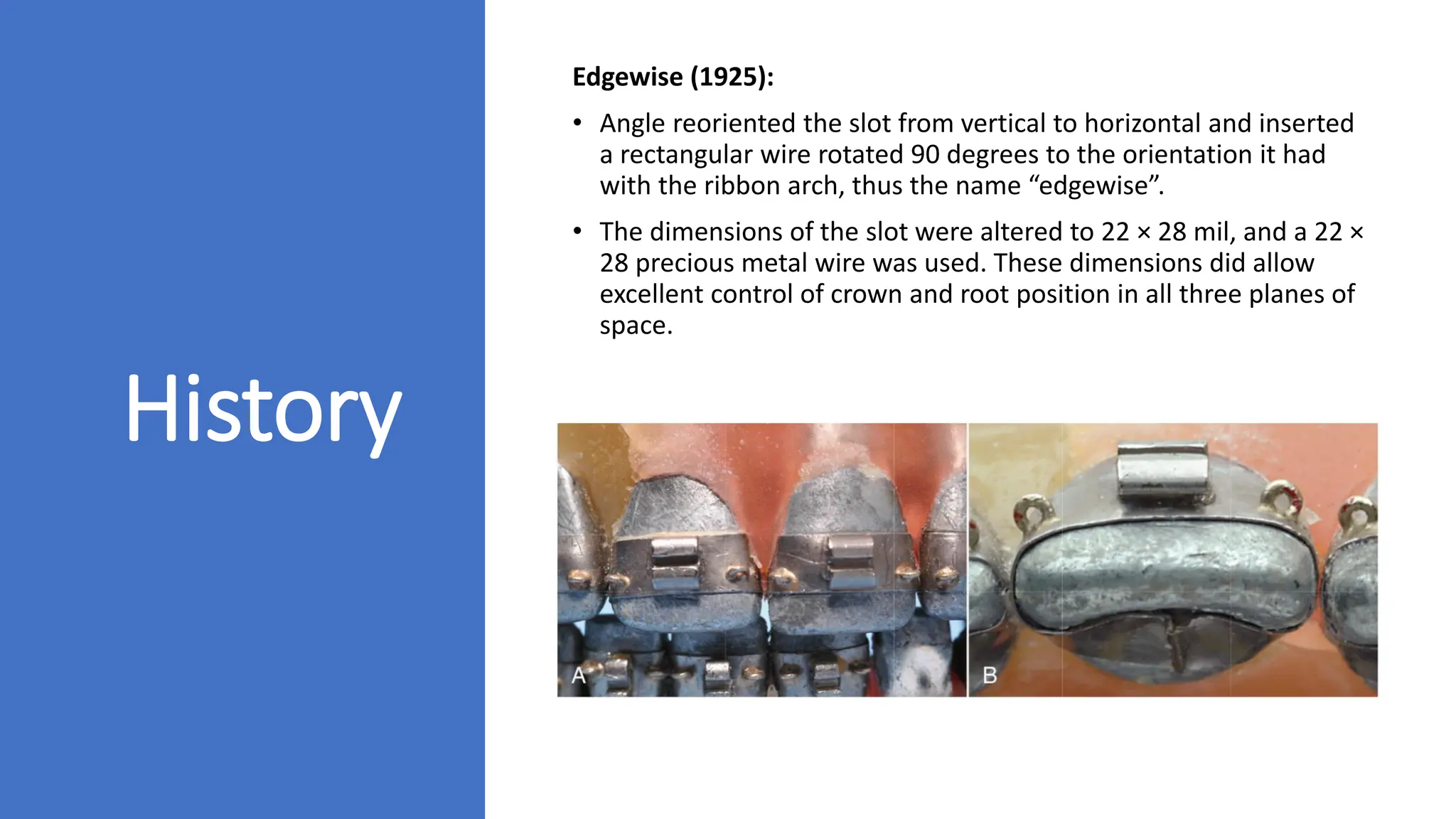 evolution of orthodontic bracket history.pdf