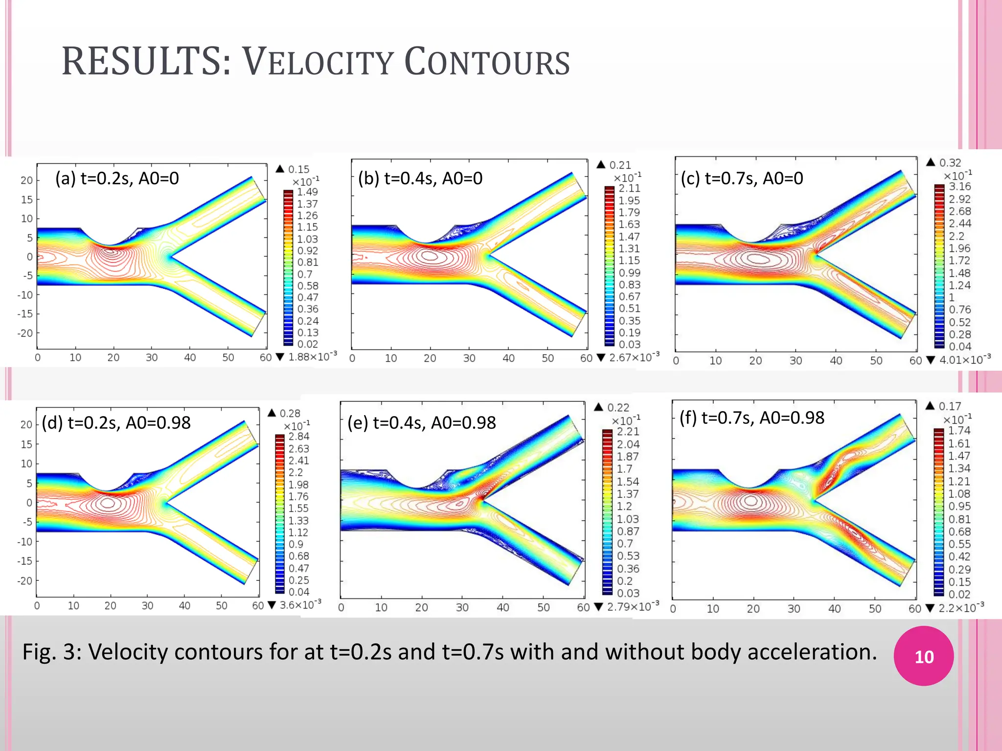 Computational simulation of blood flow in stenosed Arterial Bifurcation ...