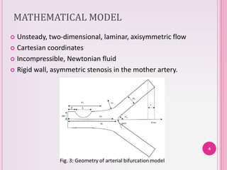 Computational simulation of blood flow in stenosed Arterial Bifurcation under body Acceleration ...