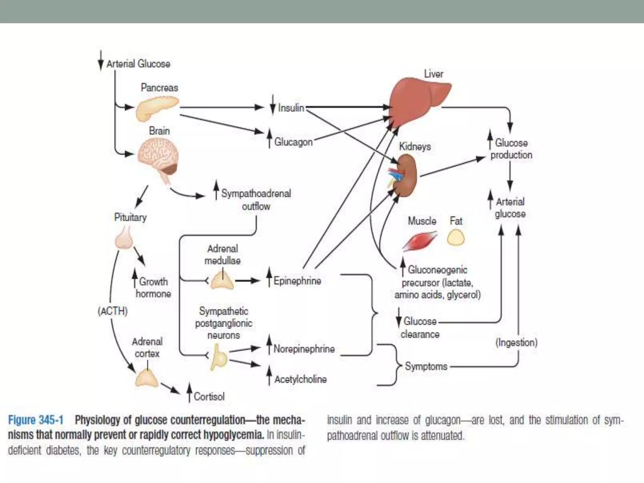 hypoglycemia | PPTX