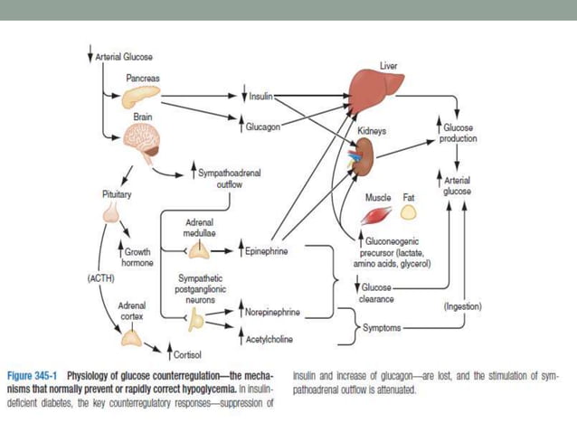 hypoglycemia | PPTX