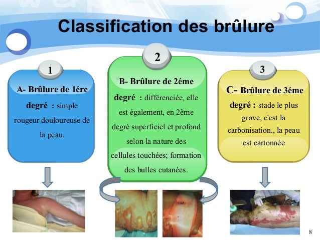 Ahmed representation 1