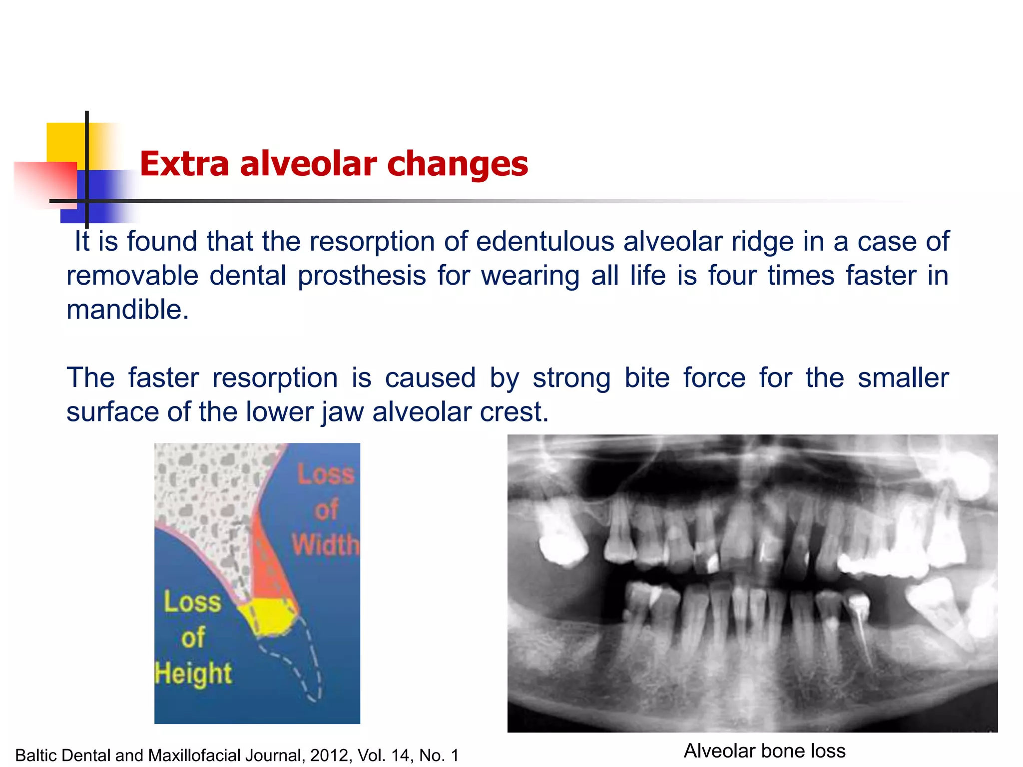 alveolar ridge expansion and socket preservation | PPT | Bone and Joint ...