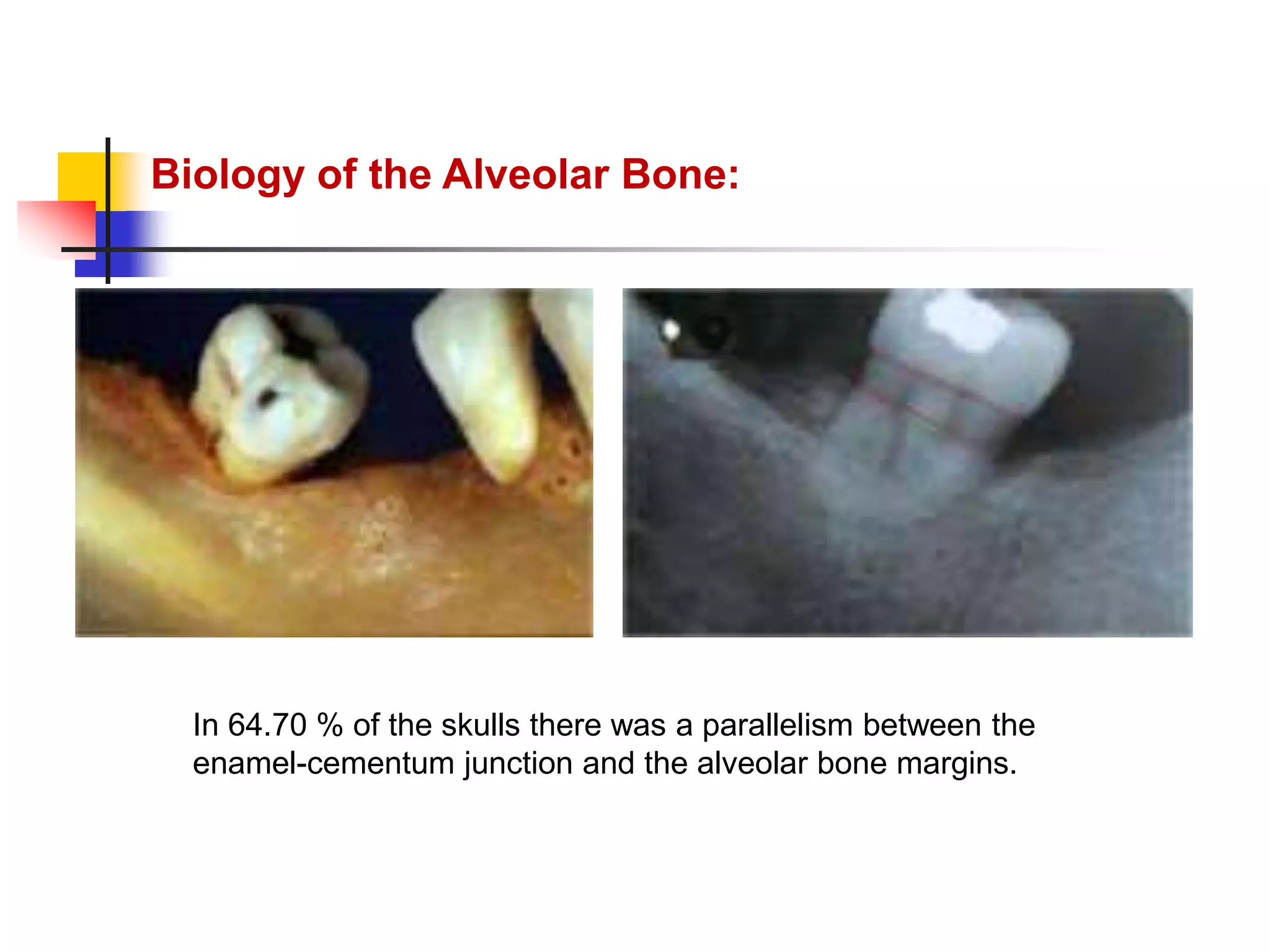 alveolar ridge expansion and socket preservation | PPT