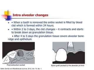 alveolar ridge expansion and socket preservation | PPT